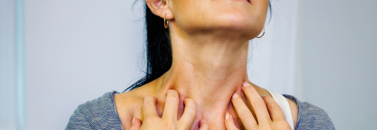 Causes of A Rash On Neck That Itches