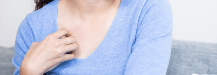 What To Do About Itchy Rashes on the Chest